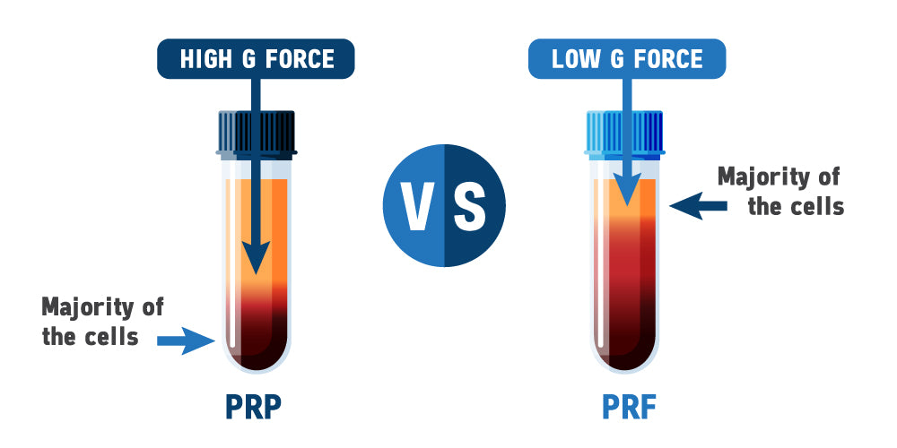 Unveiling the Difference: PRP vs. PRF in Regenerative Medicine