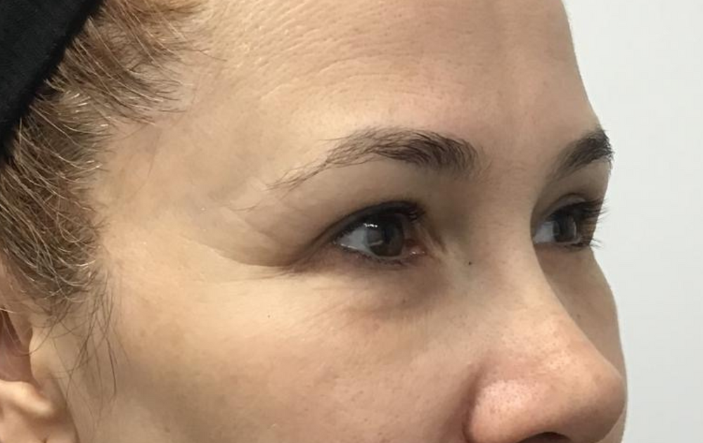 T-Lab™ PRX Tubes (PRF/Platelet-Rich Fibrin Tubes)