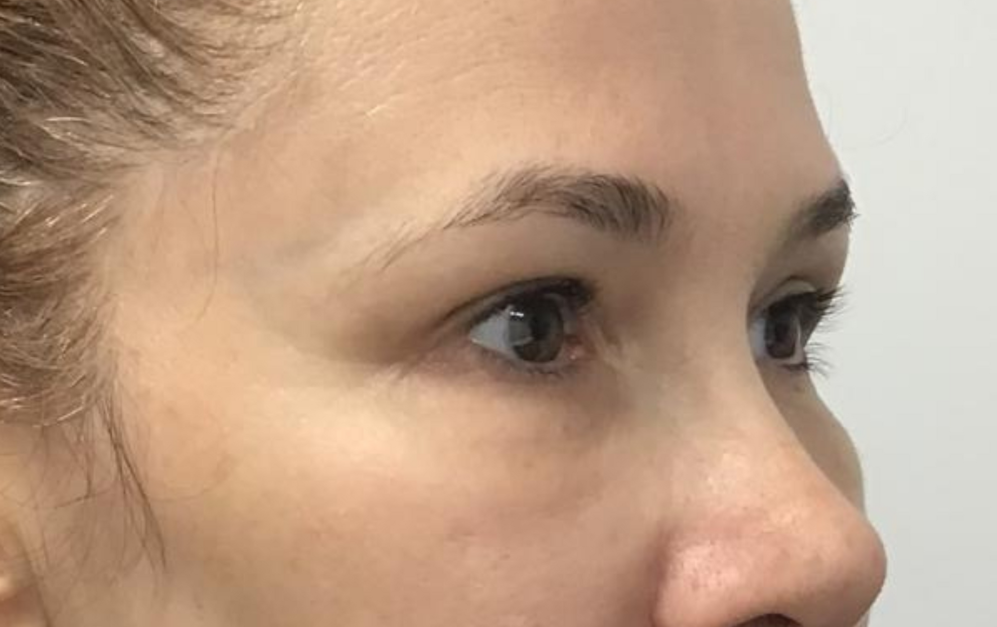 T-Lab™ PRX Tubes (PRF/Platelet-Rich Fibrin Tubes)