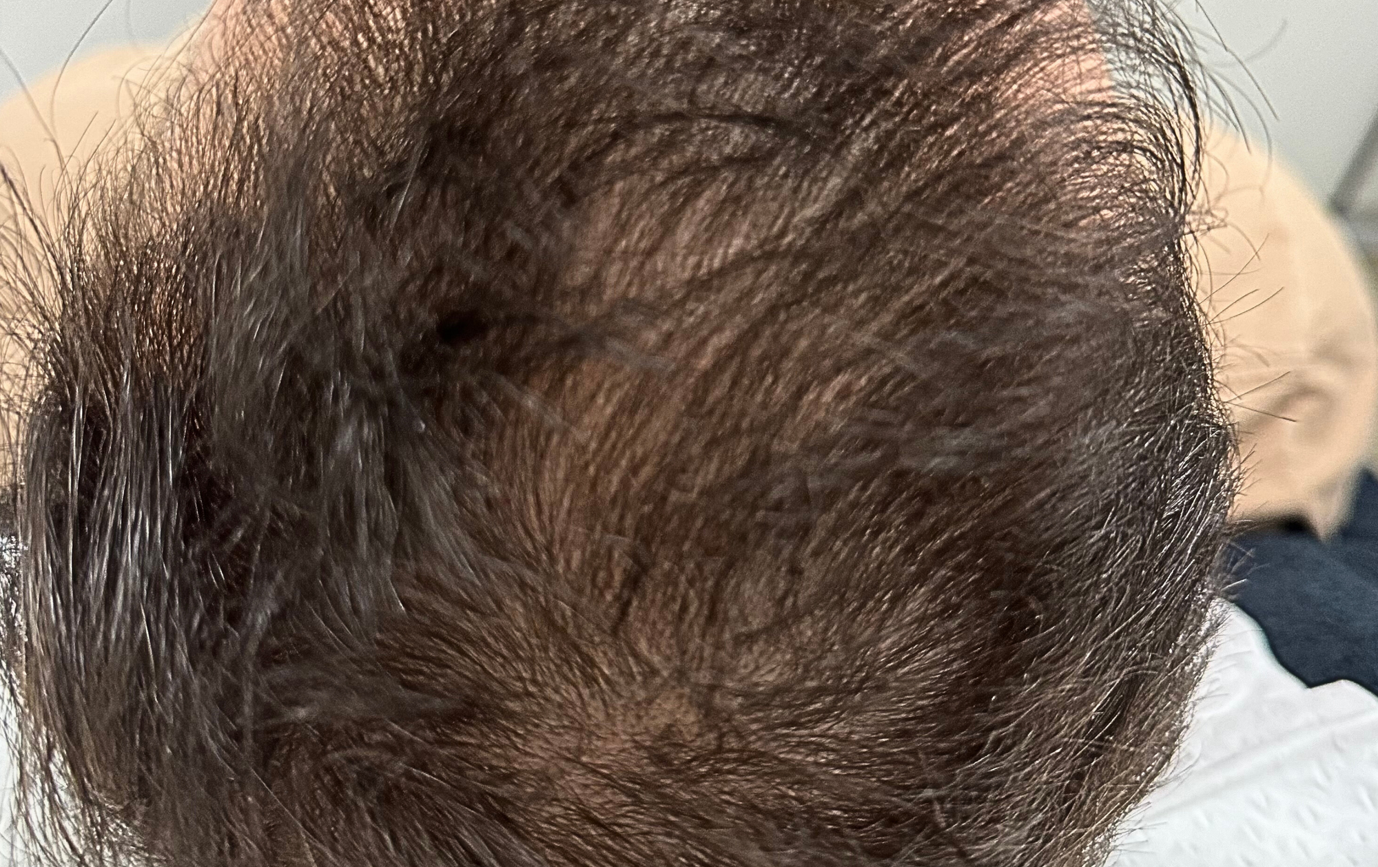 T-Lab™ PRP Kits and Tubes (Platelet-Rich Plasma Tubes)